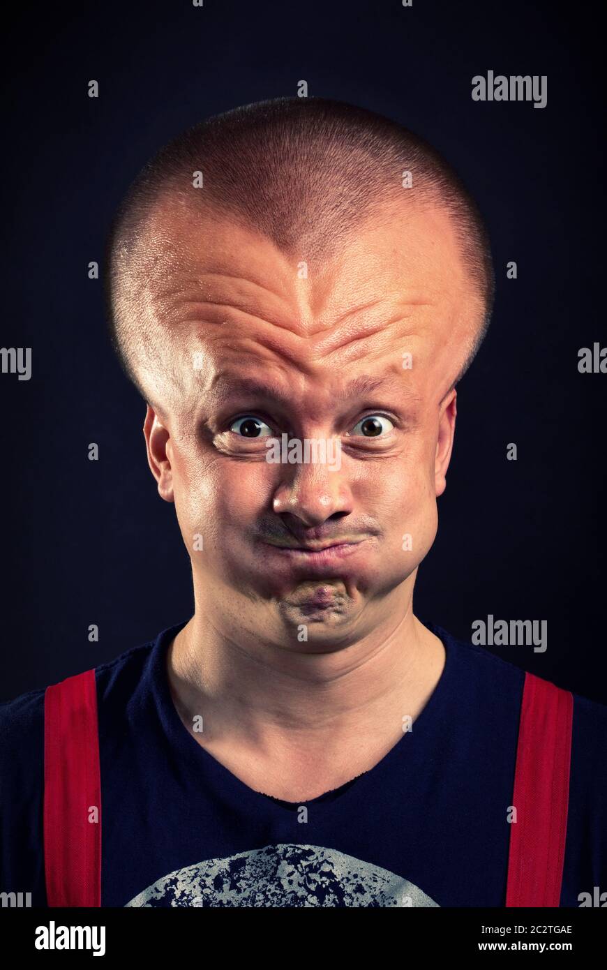 Stressed man with inflated head Stock Photo - Alamy