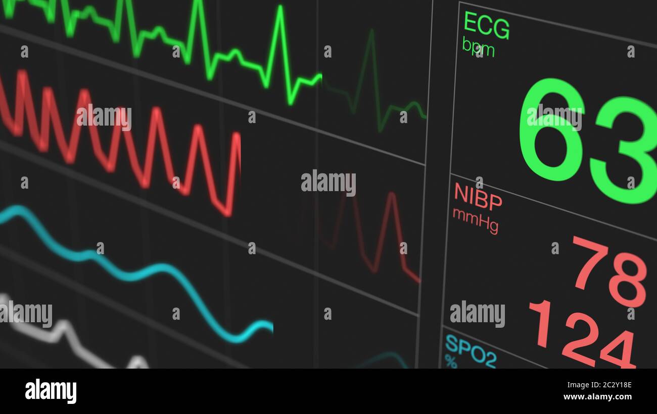 closeup view of an ecg ekg display Stock Photo - Alamy