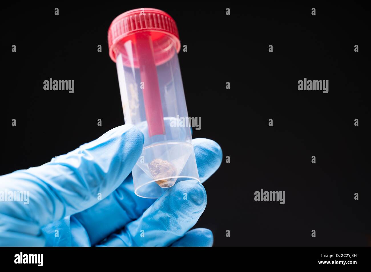 Doctor Hand With Plastic Container Sampling Of Feces Stock Photo - Alamy