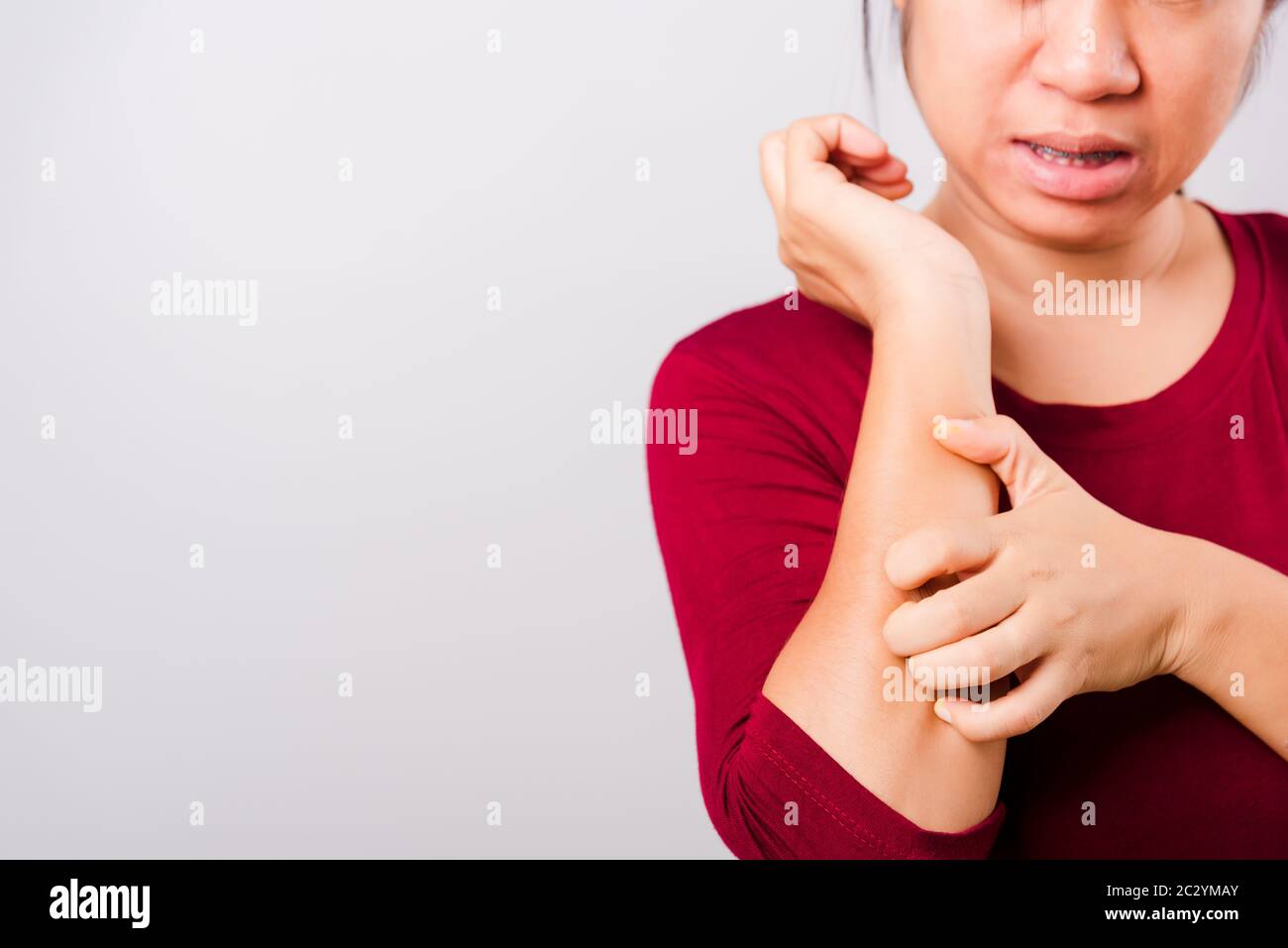 Asian Beautiful Woman Itching Her Scratching Her Itchy Arm On White Background With Copy Space