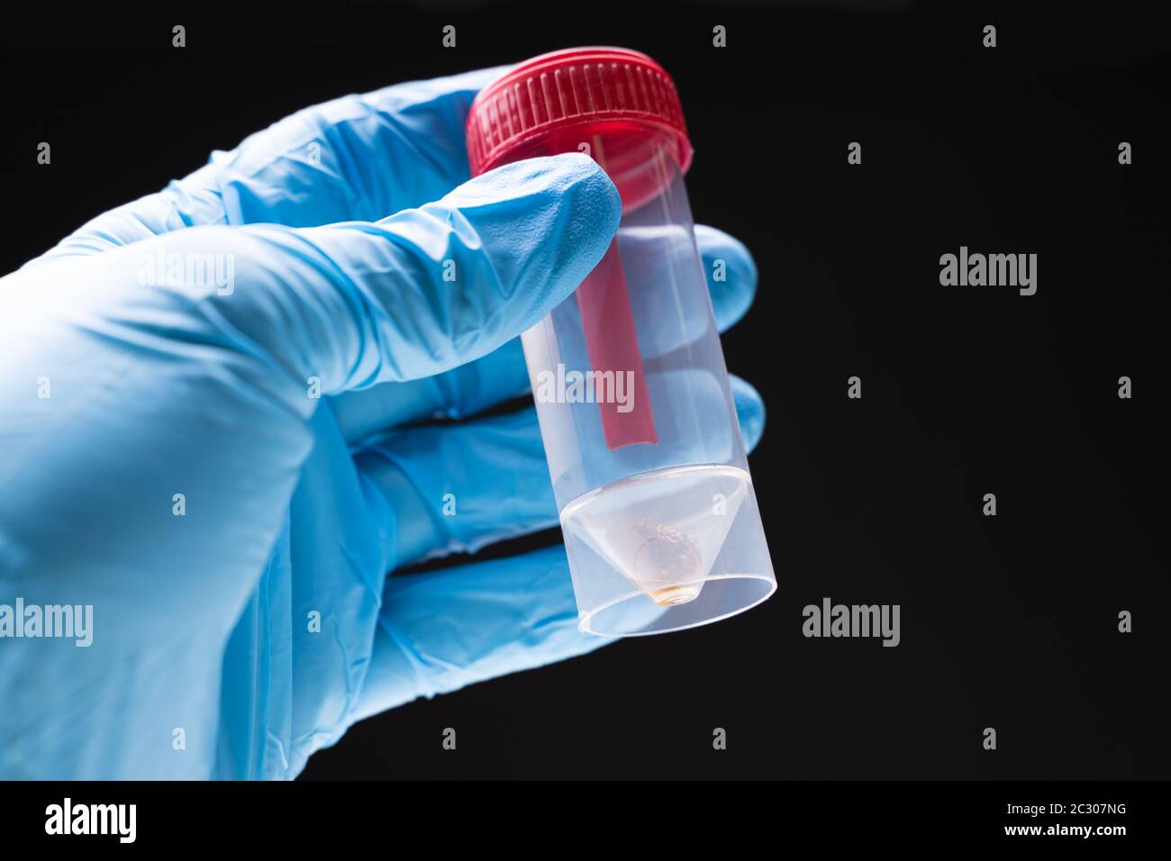 Stool specimen container hi-res stock photography and images - Alamy
