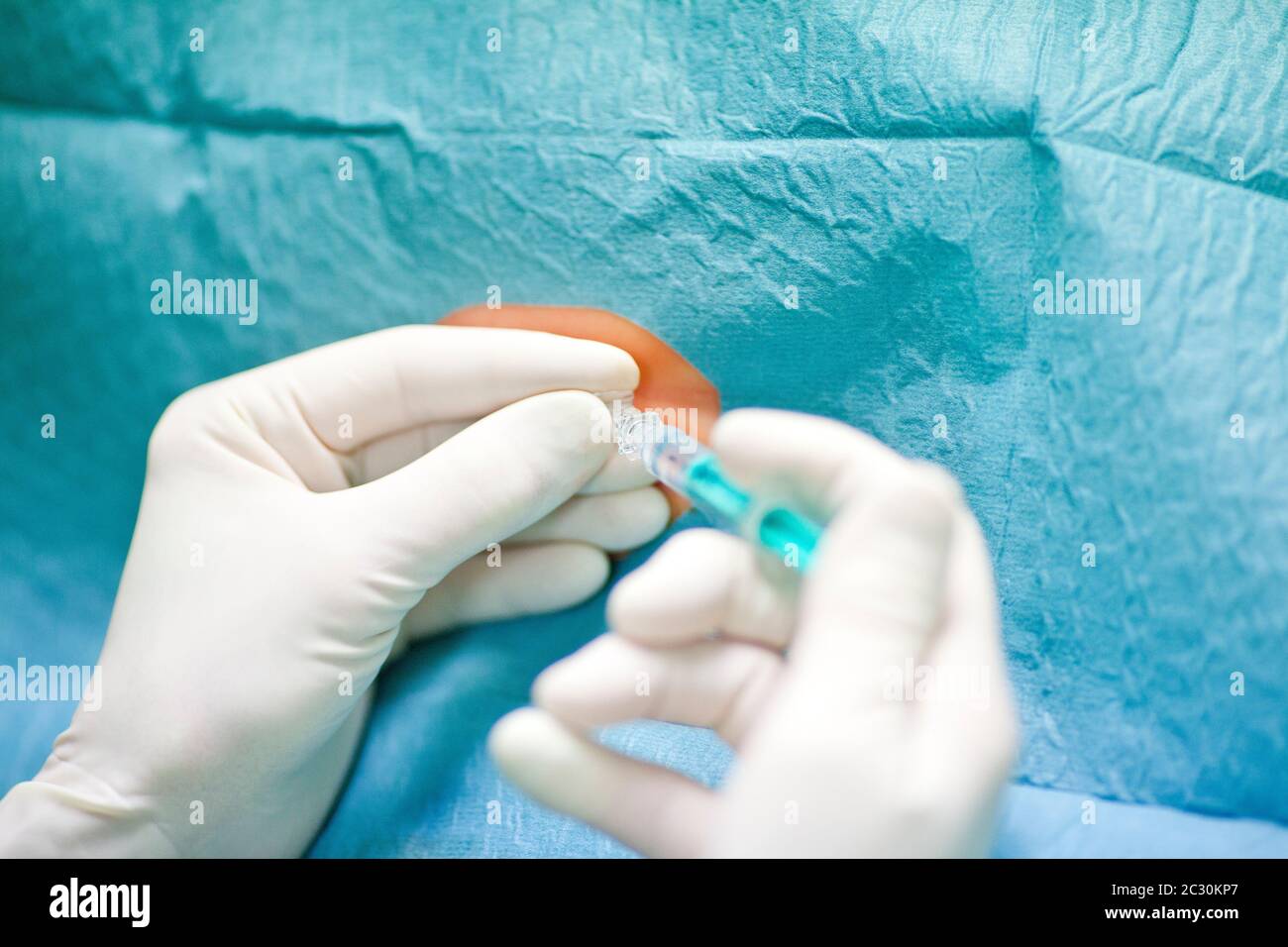 closeup of doctors hands with anesthetic syringe in sterile operating ...