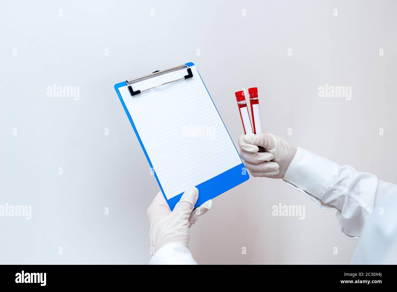 Laboratory Blood Test Sample Shown For Medical Diagnostic Analysis ...