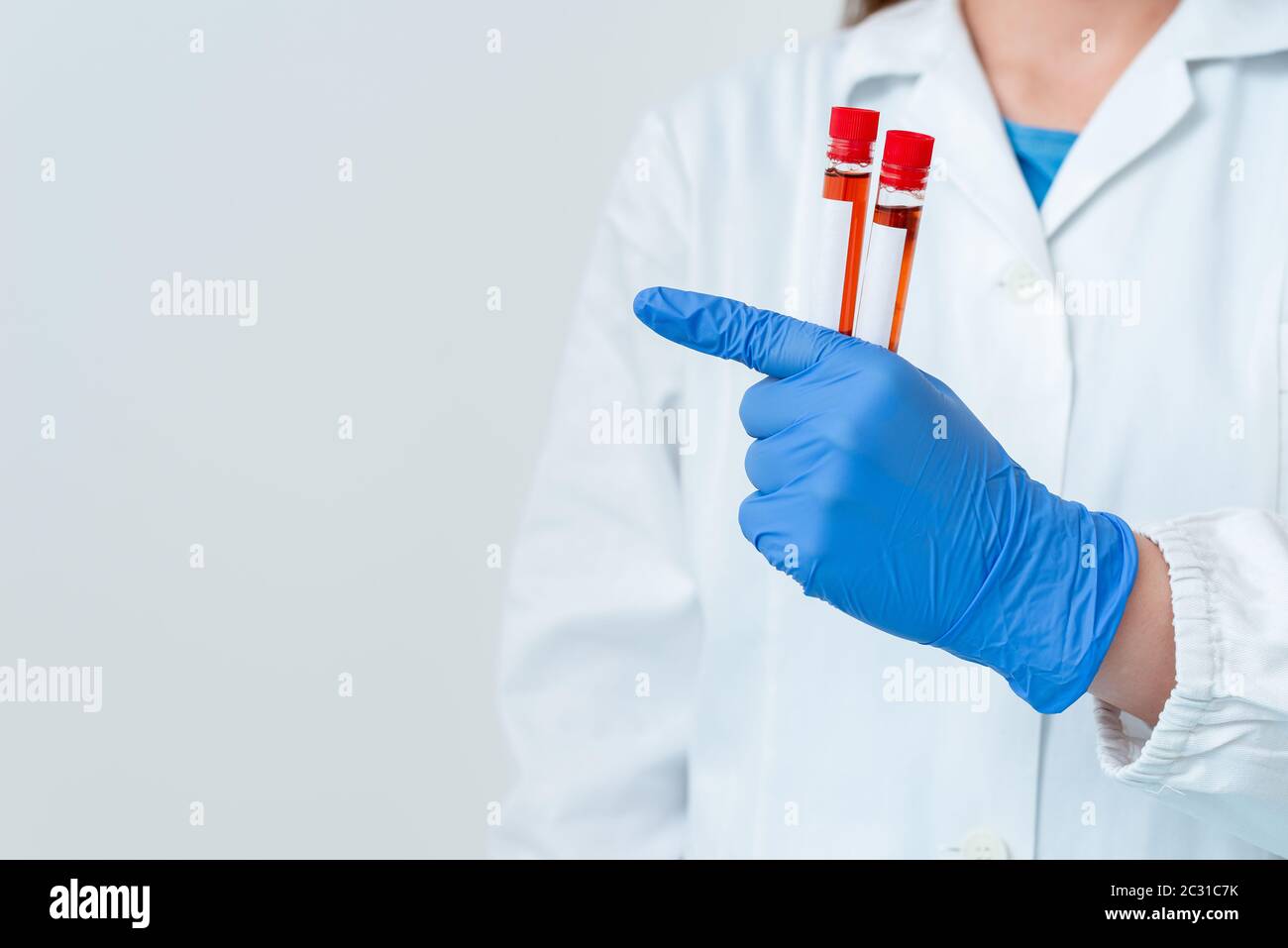 Laboratory Blood Test Sample Shown For Medical Diagnostic Analysis ...