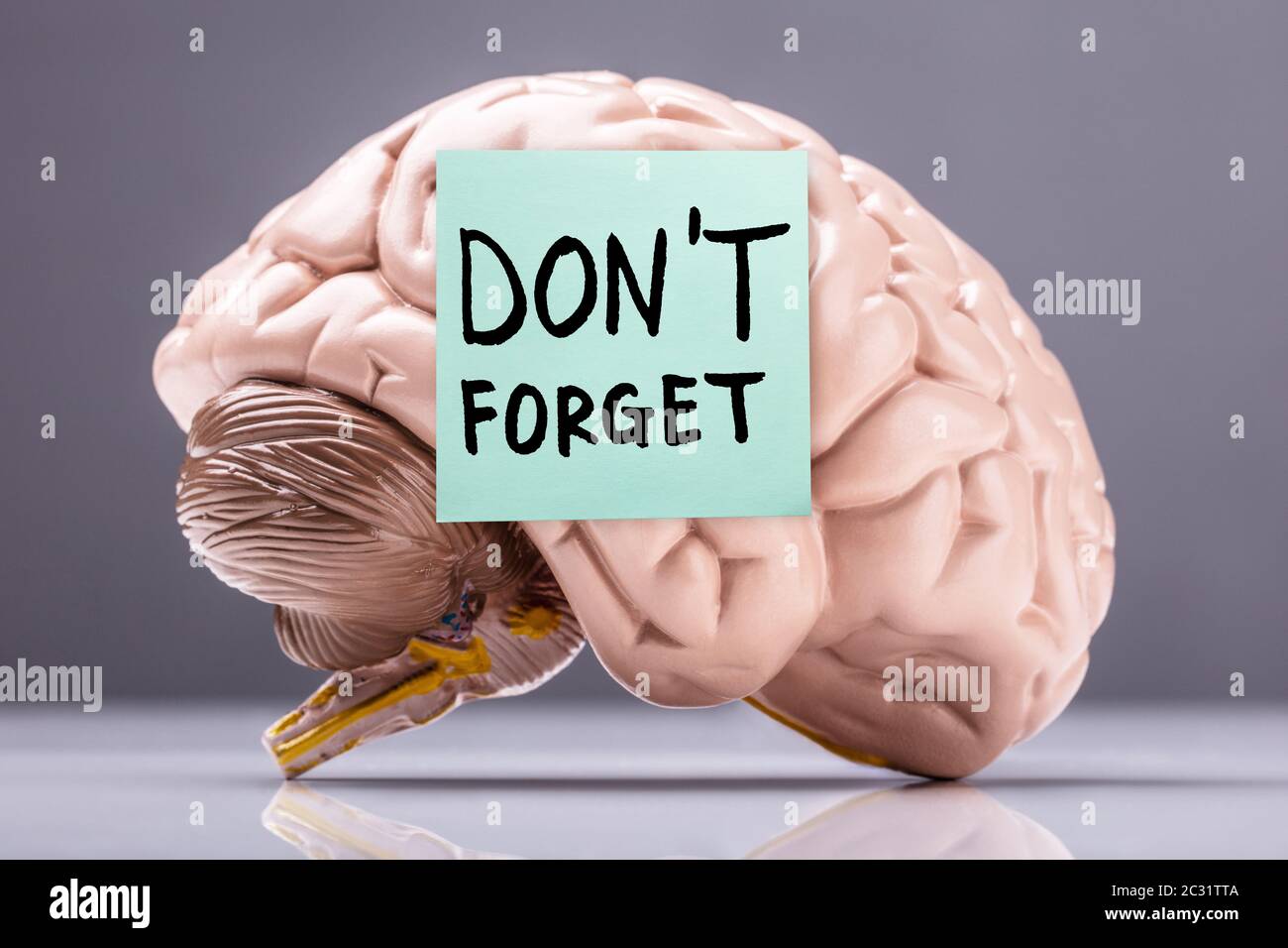 Adhesive Note With Don't Forget Text Stuck On Brain Model Over ...