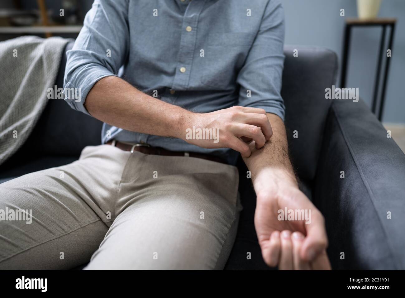 Skin rash african hi-res stock photography and images - Alamy