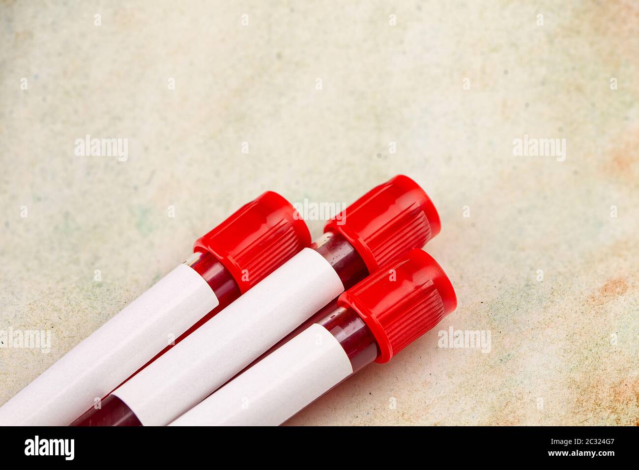 Blood sample in test tube with empty white sticker for text Stock Photo ...