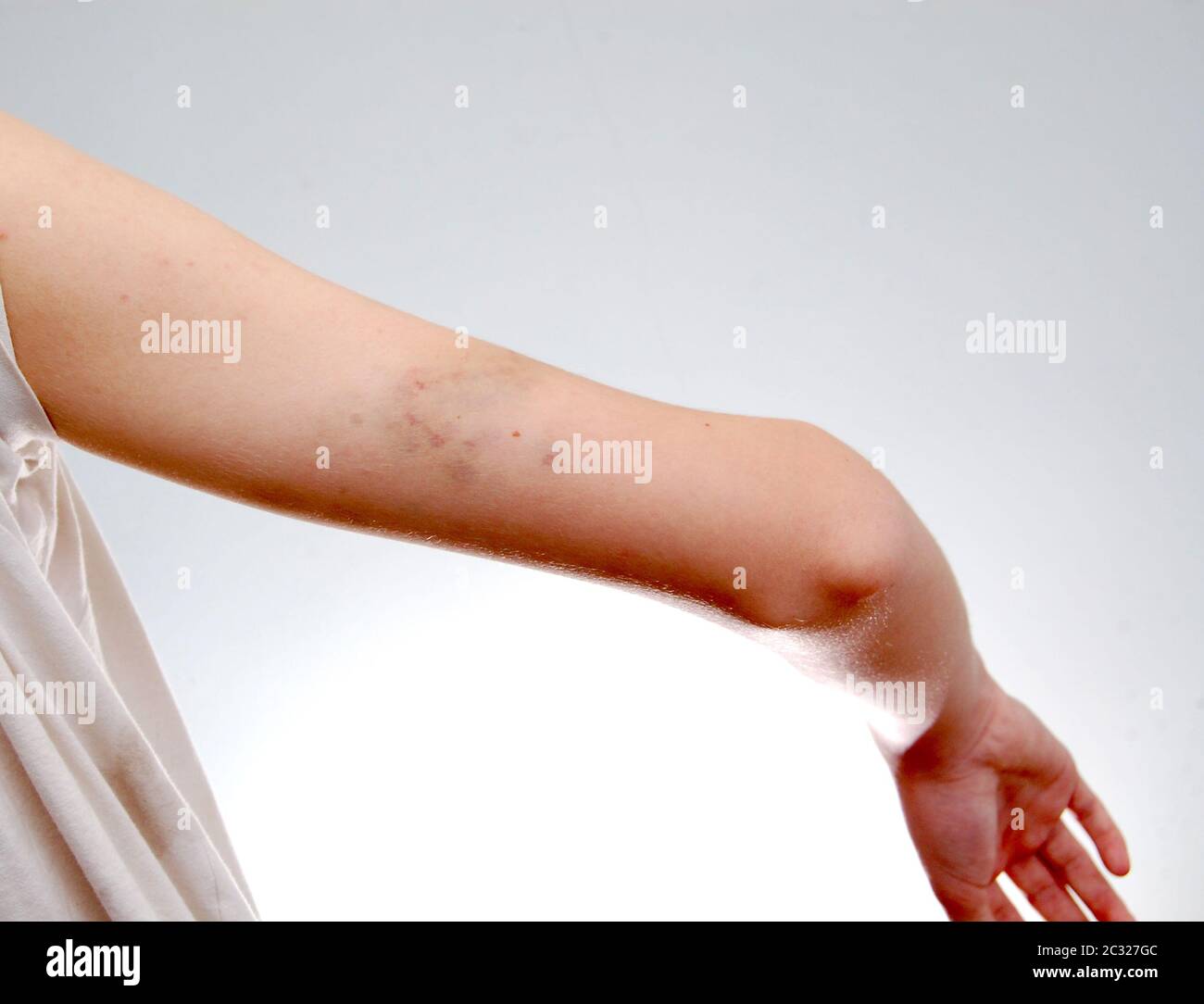 hand arm of young man image of Stock Photo - Alamy