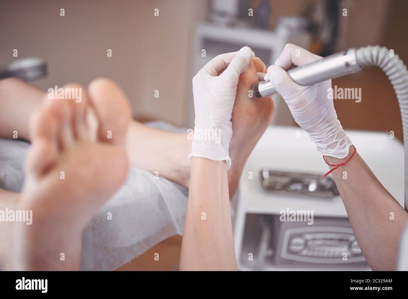 Podiatrist using grinding equipment and making procedure polish for ...