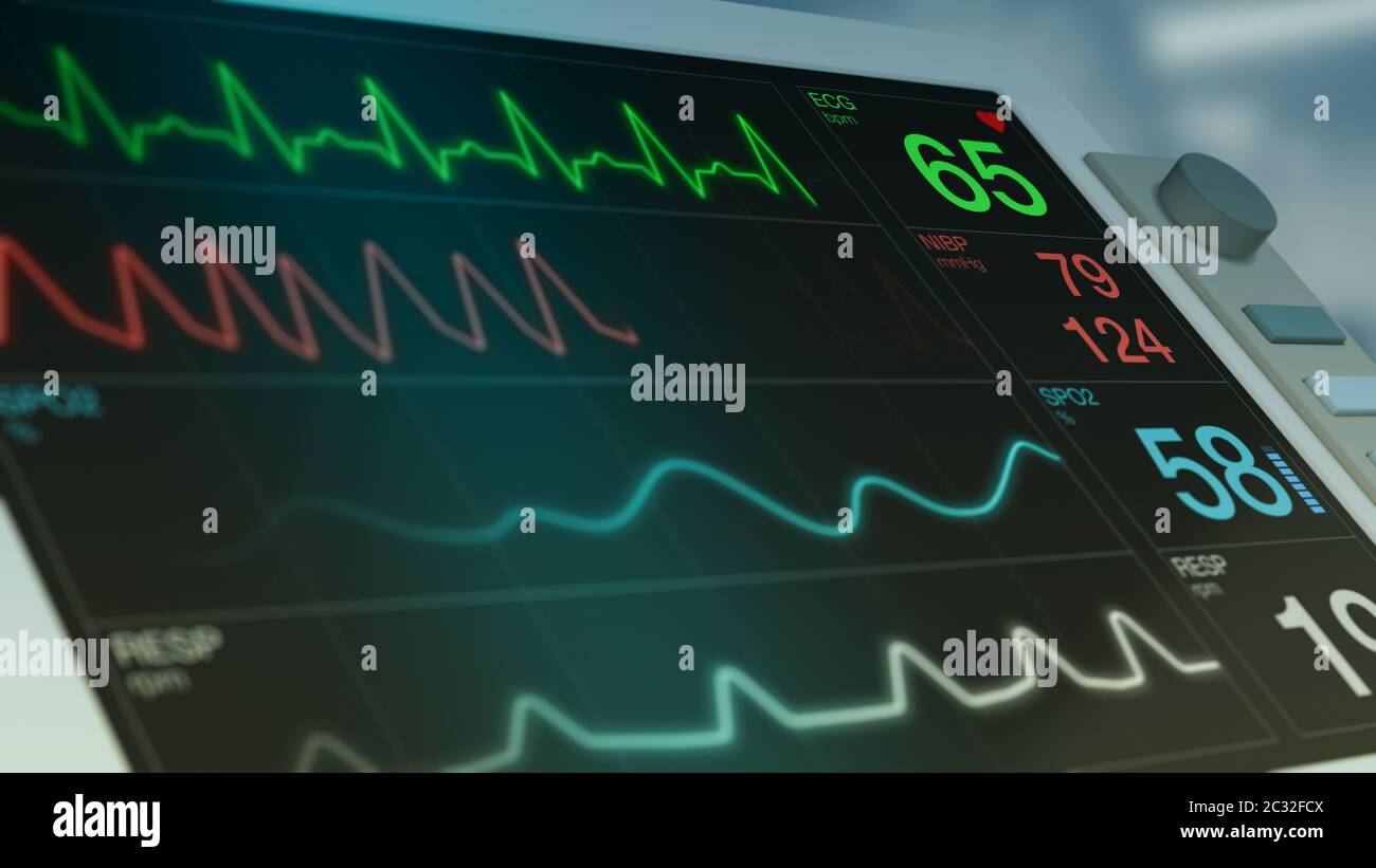 closeup view of an ecg ekg monitor on a operating room Stock Photo - Alamy