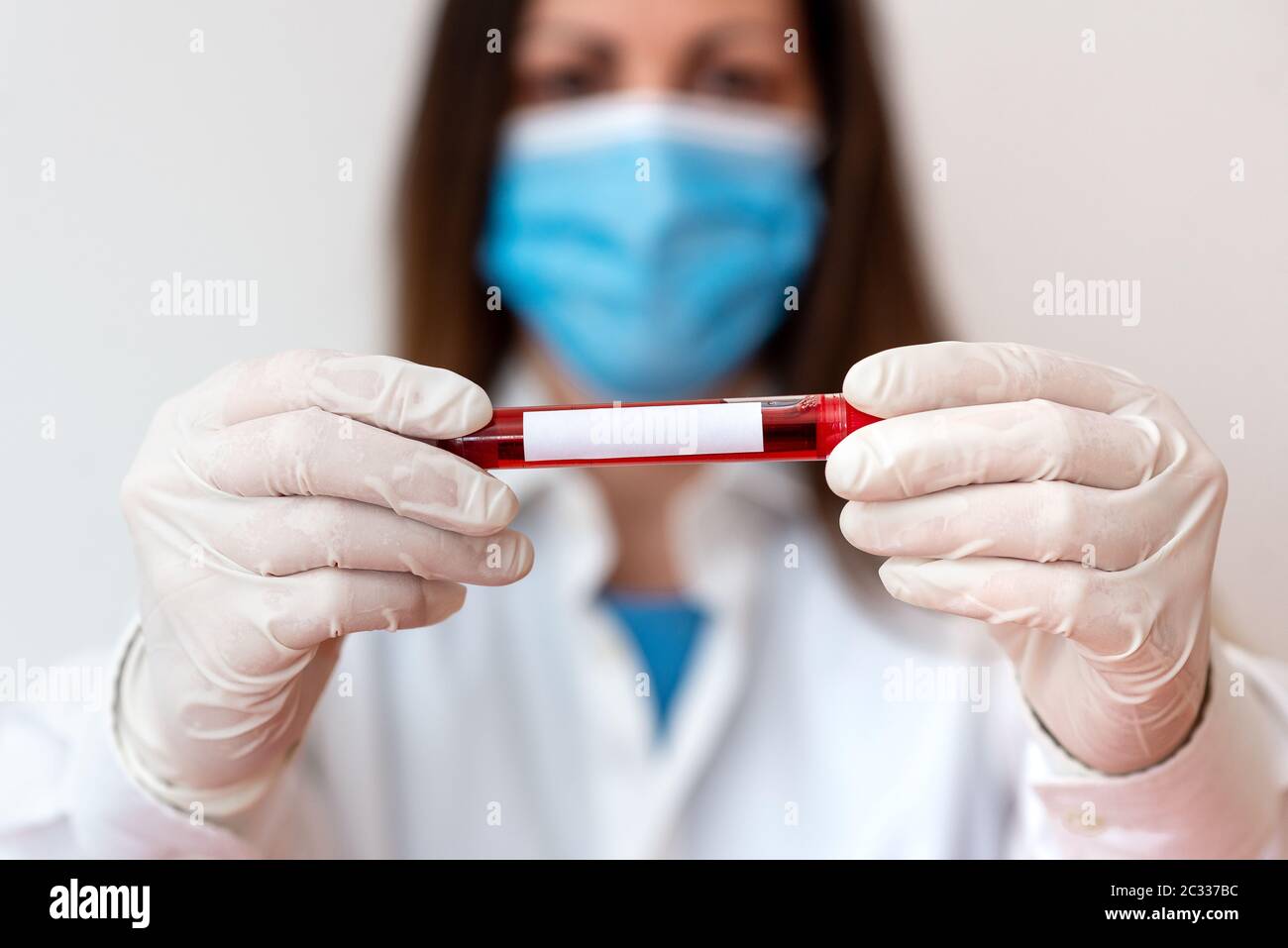 Laboratory Blood Test Sample Shown For Medical Diagnostic Analysis ...