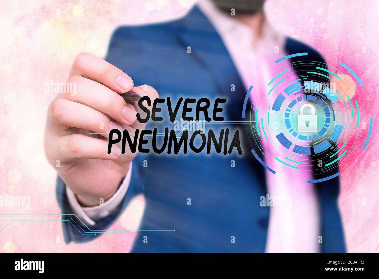 Handwriting text writing Severe Pneumonia. Conceptual photo acute ...