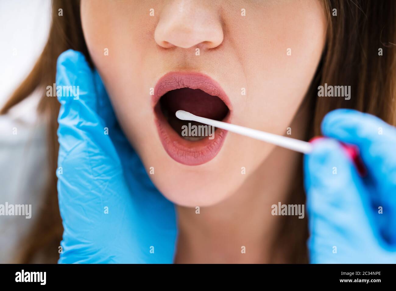 Rear View Of A Male Doctor Taking A Bodily Fluid Sample For DNA Test ...
