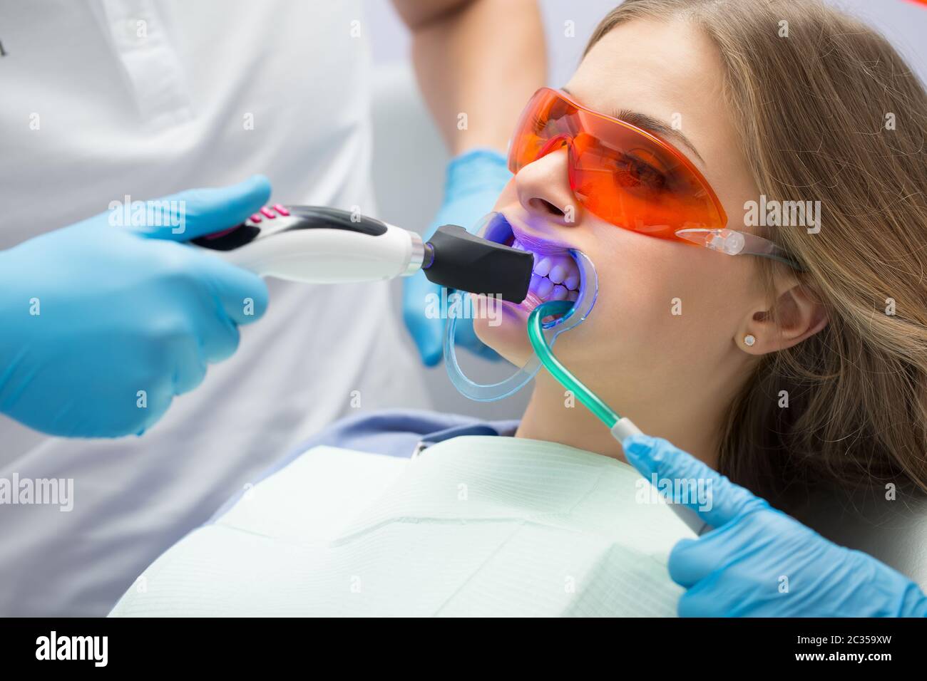 Tooth filling ultraviolet lamp Stock Photo - Alamy