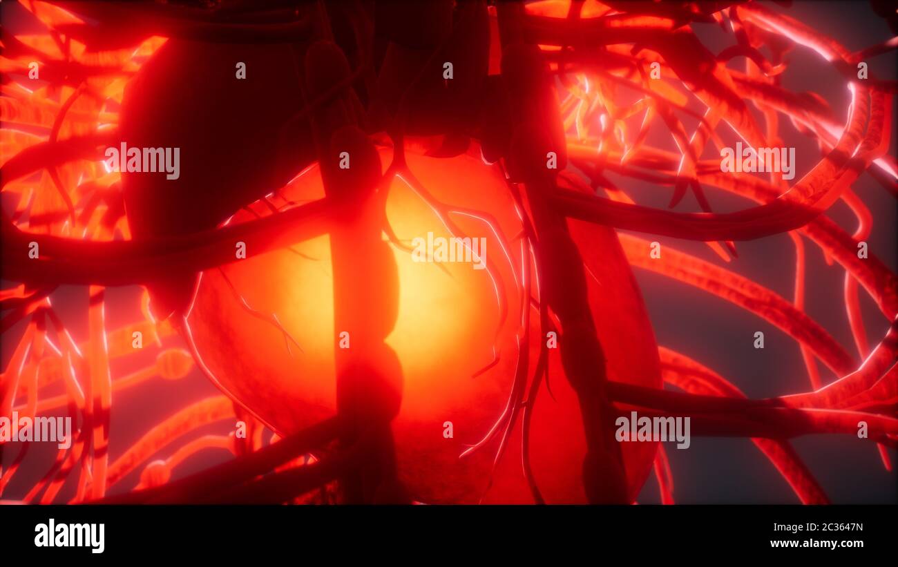 Coronary angiogram hi-res stock photography and images - Alamy