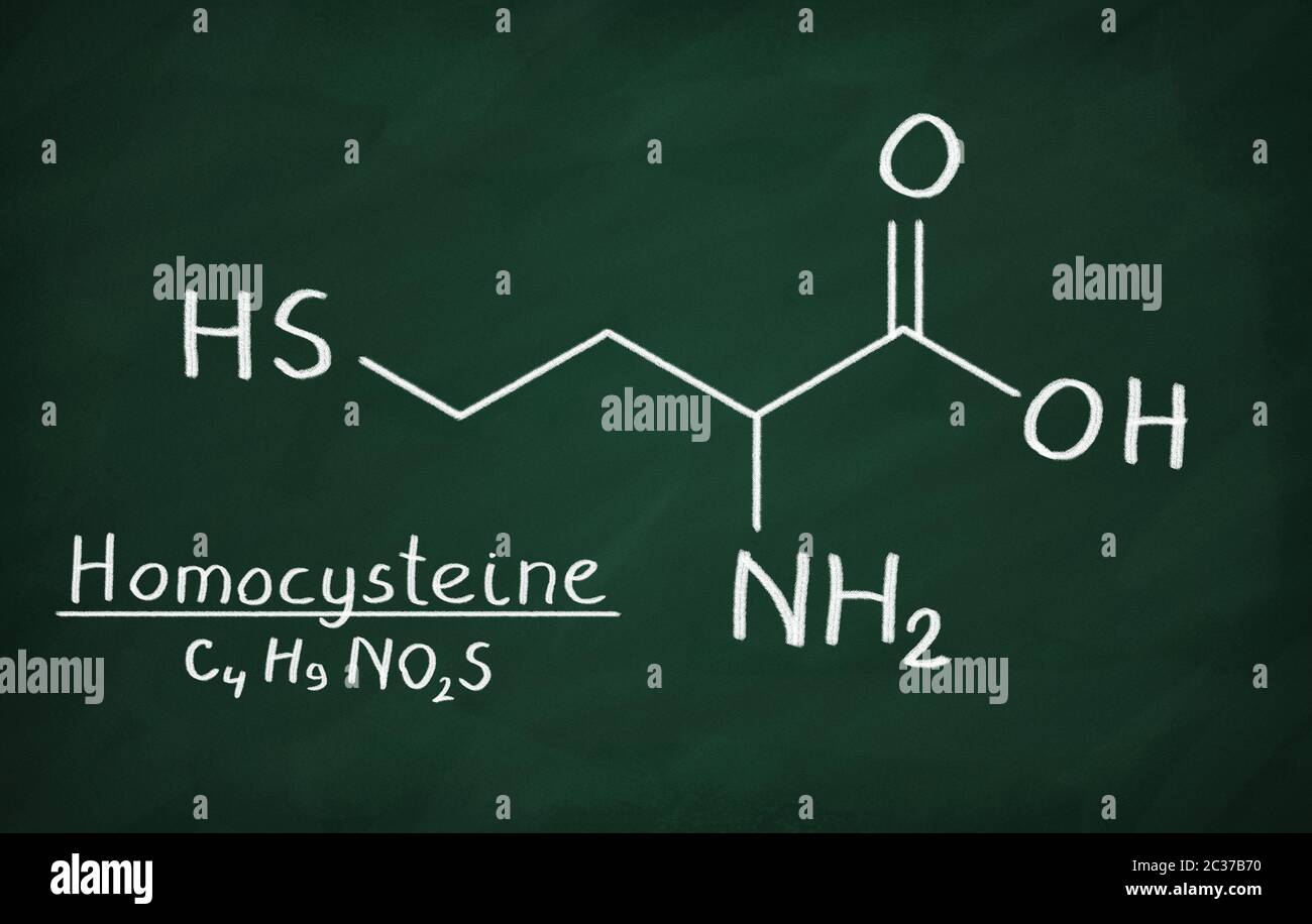 Chemical formula of Homocysteine on a blackboard Stock Photo - Alamy