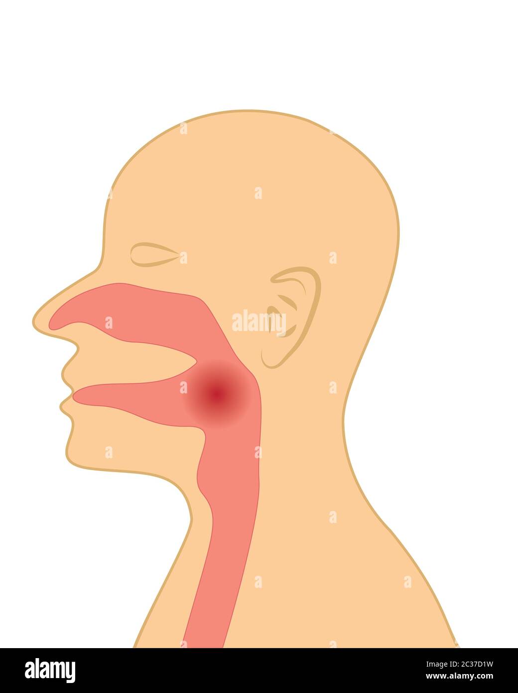 Sore throat vector illustration on a white background Stock Photo - Alamy