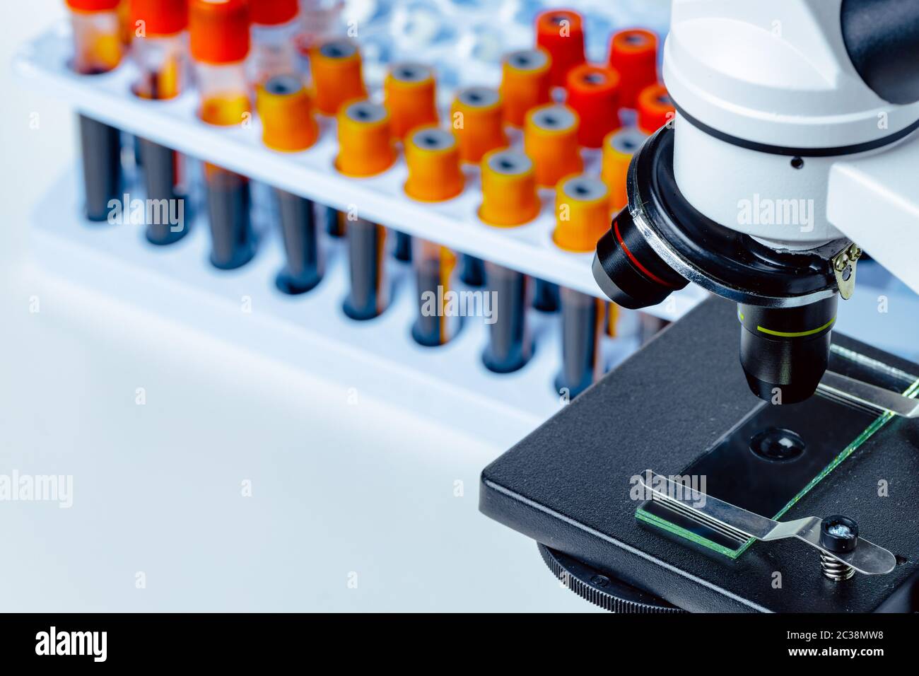 Microscope with blood samples test tubes close up Stock Photo - Alamy