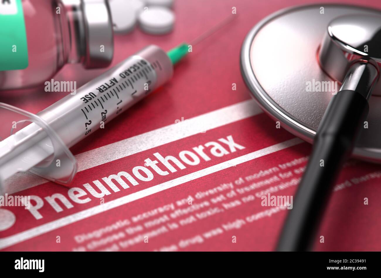 Pneumothorax hi-res stock photography and images - Alamy
