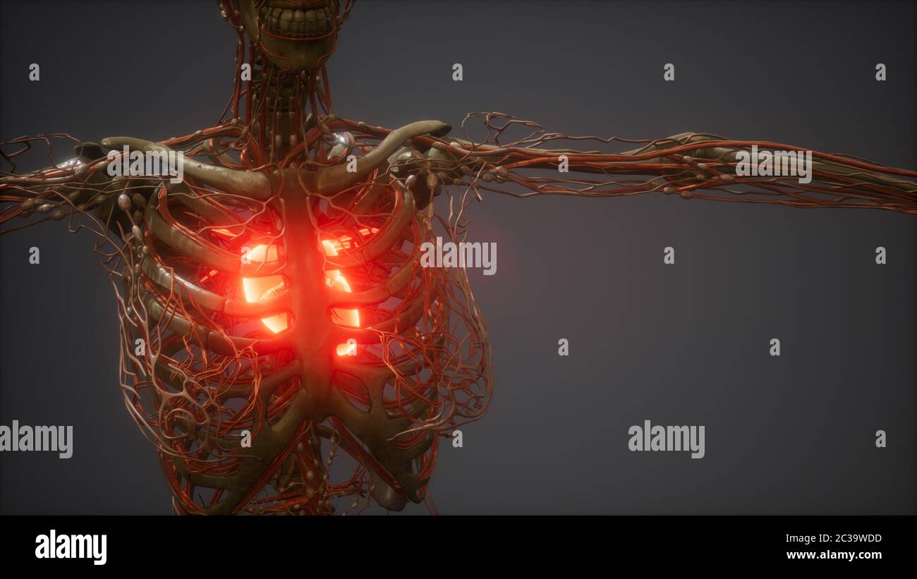 CG Animation Of A Sick Human Heart Stock Photo - Alamy
