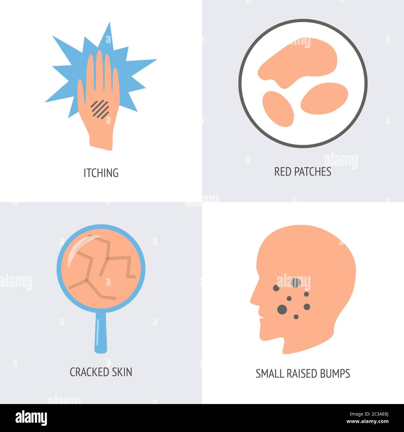 Eczema Symptoms Icon Set In Flat Style Skin Allergy Symbols Isolated