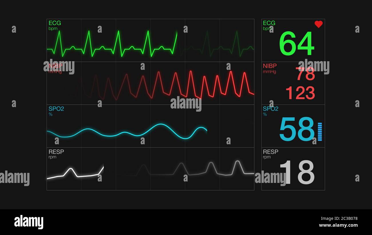 closeup view of an ecg ekg display Stock Photo - Alamy