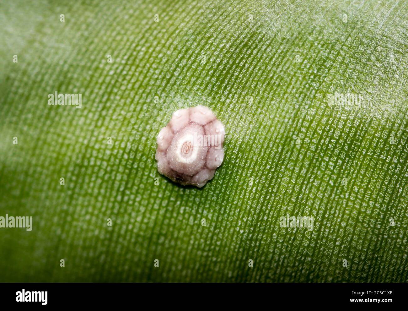 Smallpox infection hi-res stock photography and images - Alamy