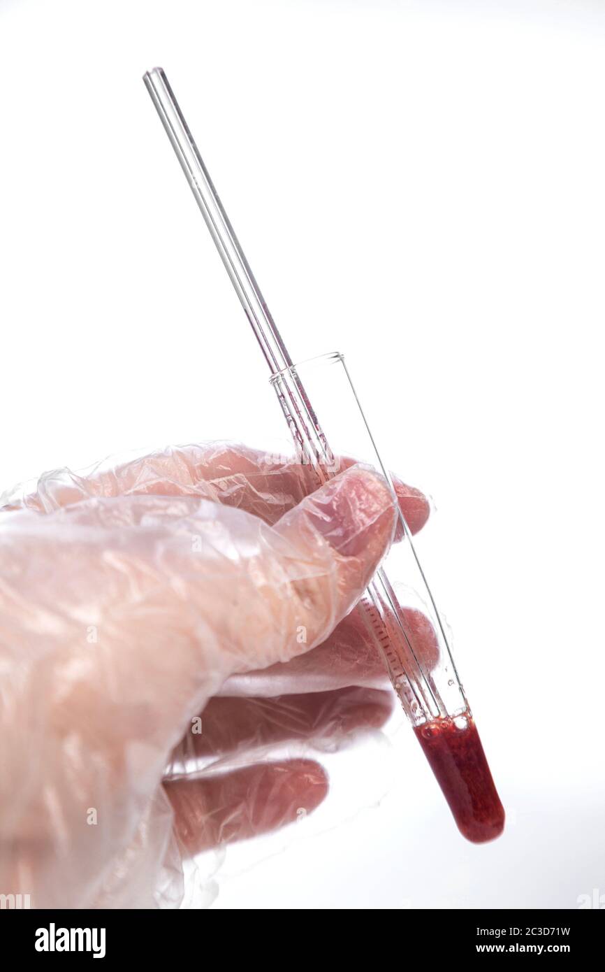 Blood test hand hi-res stock photography and images - Alamy