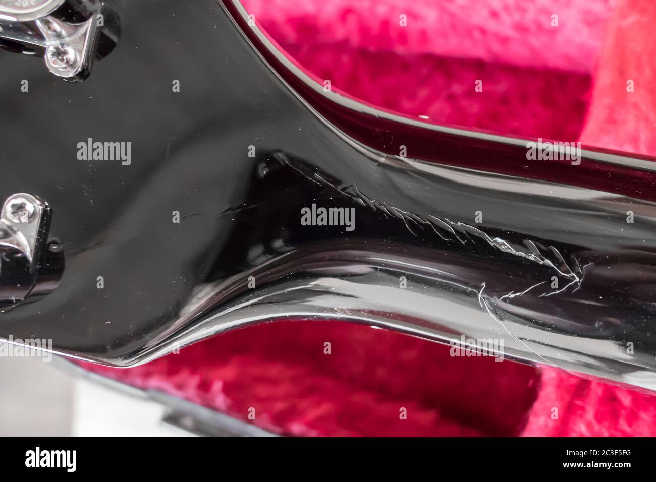 Fracture repair hi-res stock photography and images - Alamy