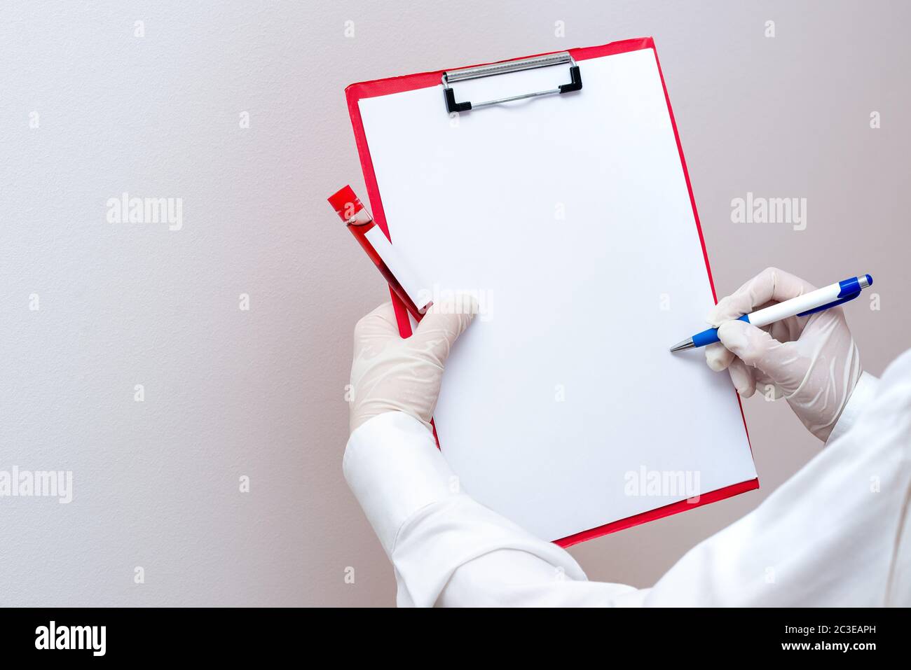Laboratory Blood Test Sample Shown For Medical Diagnostic Analysis ...