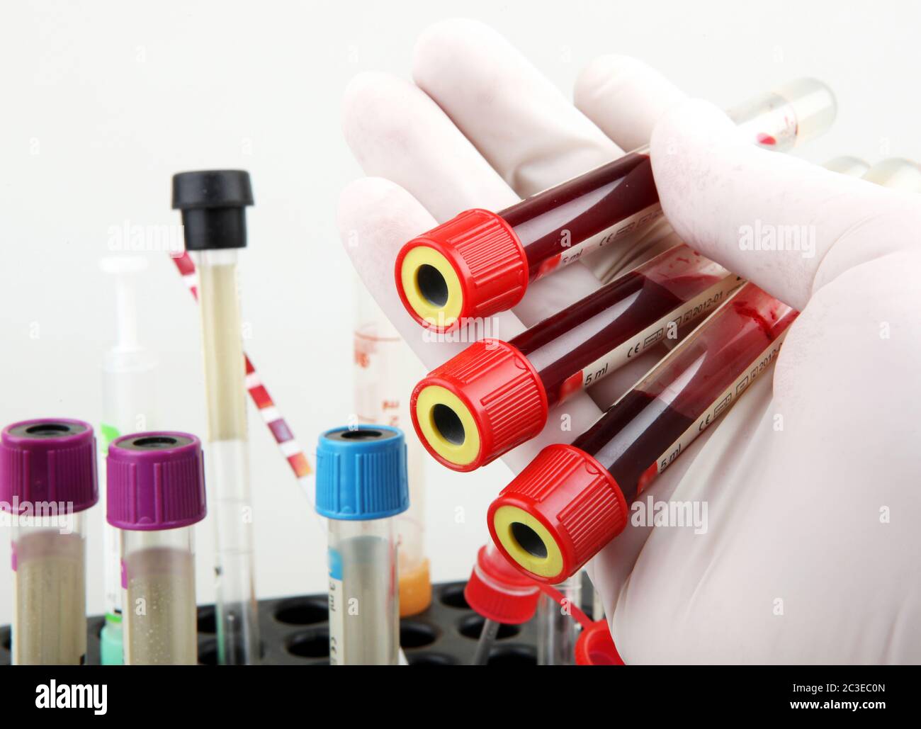 Coronavirus disease (COVID-19) research. Blood test. Regular blood ...