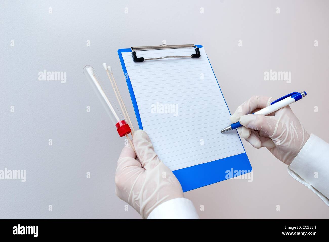 Laboratory Blood Test Sample Shown For Medical Diagnostic Analysis ...