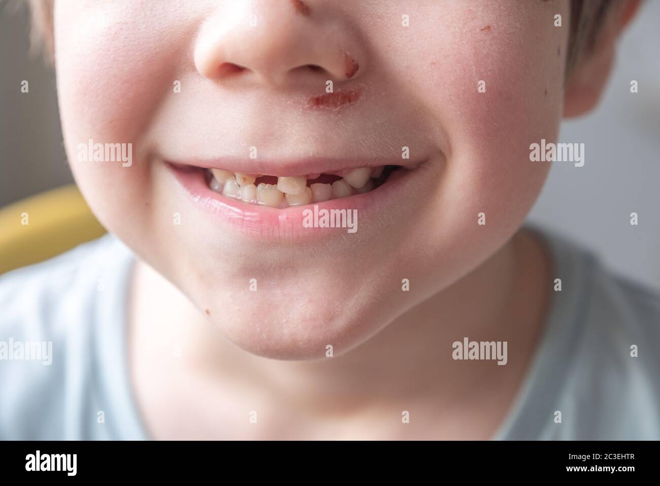 Toothless boy smiling Stock Photo - Alamy
