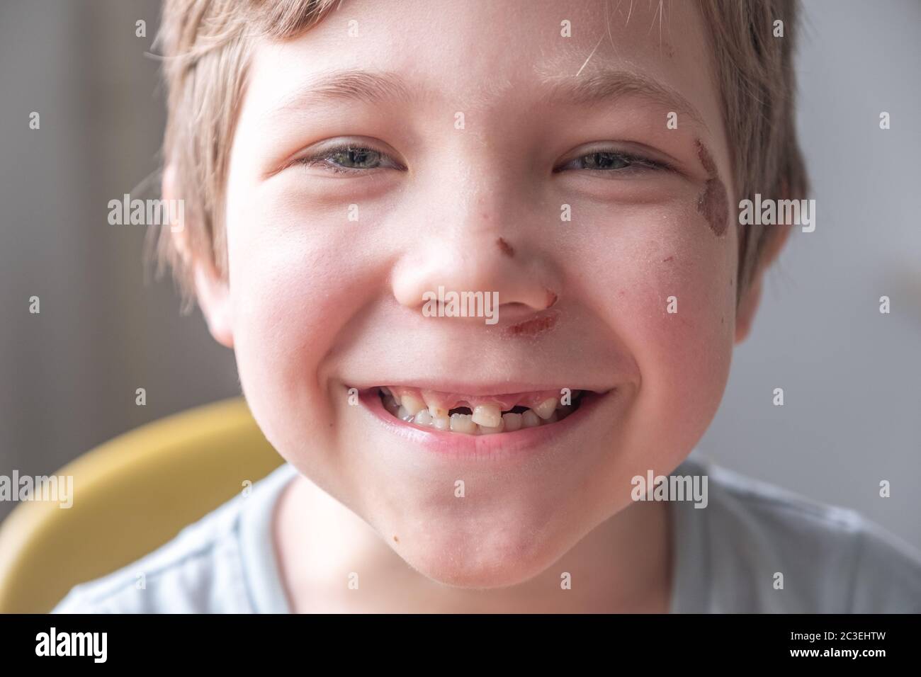 Toothless boy smiling Stock Photo - Alamy