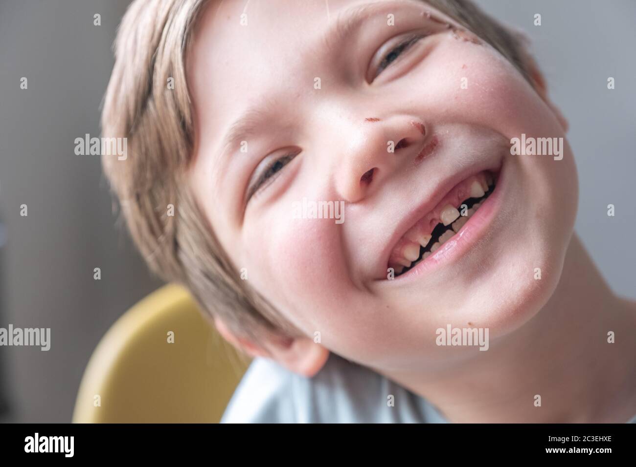 Toothless smiling boy hi-res stock photography and images - Alamy