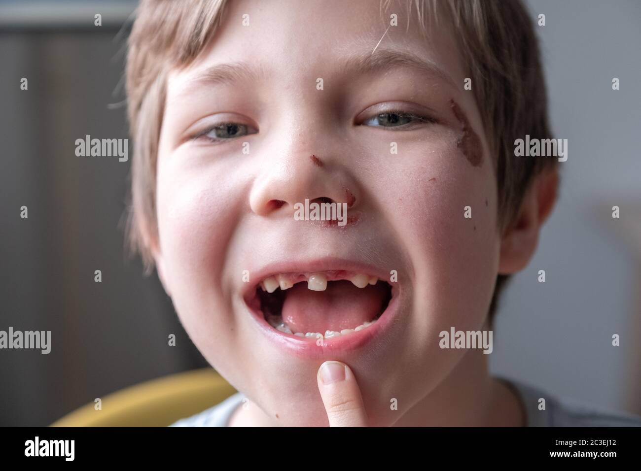 Toothless boy smiling Stock Photo - Alamy