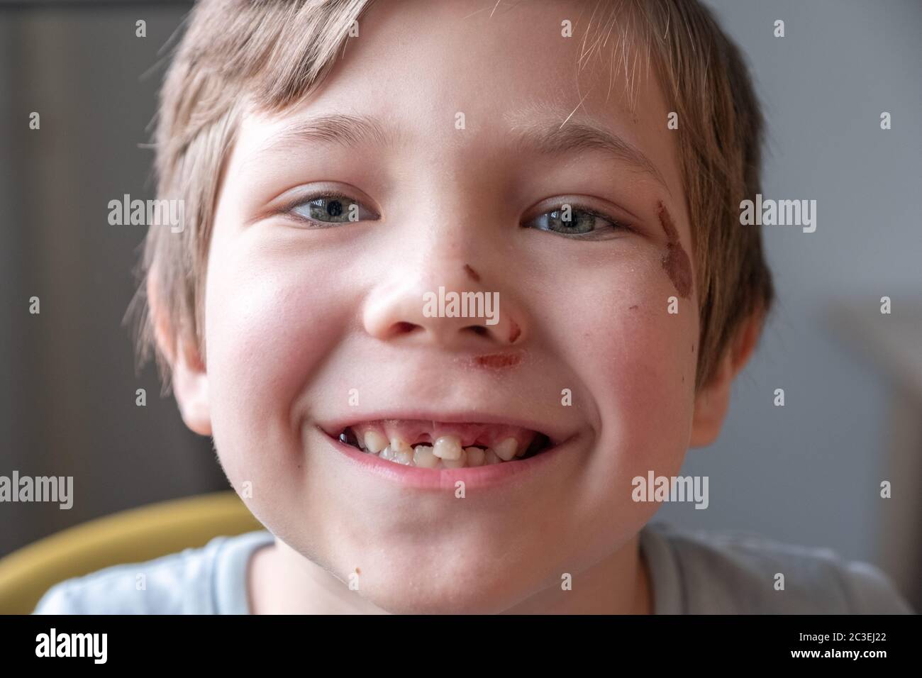 Toothless boy smiling Stock Photo - Alamy