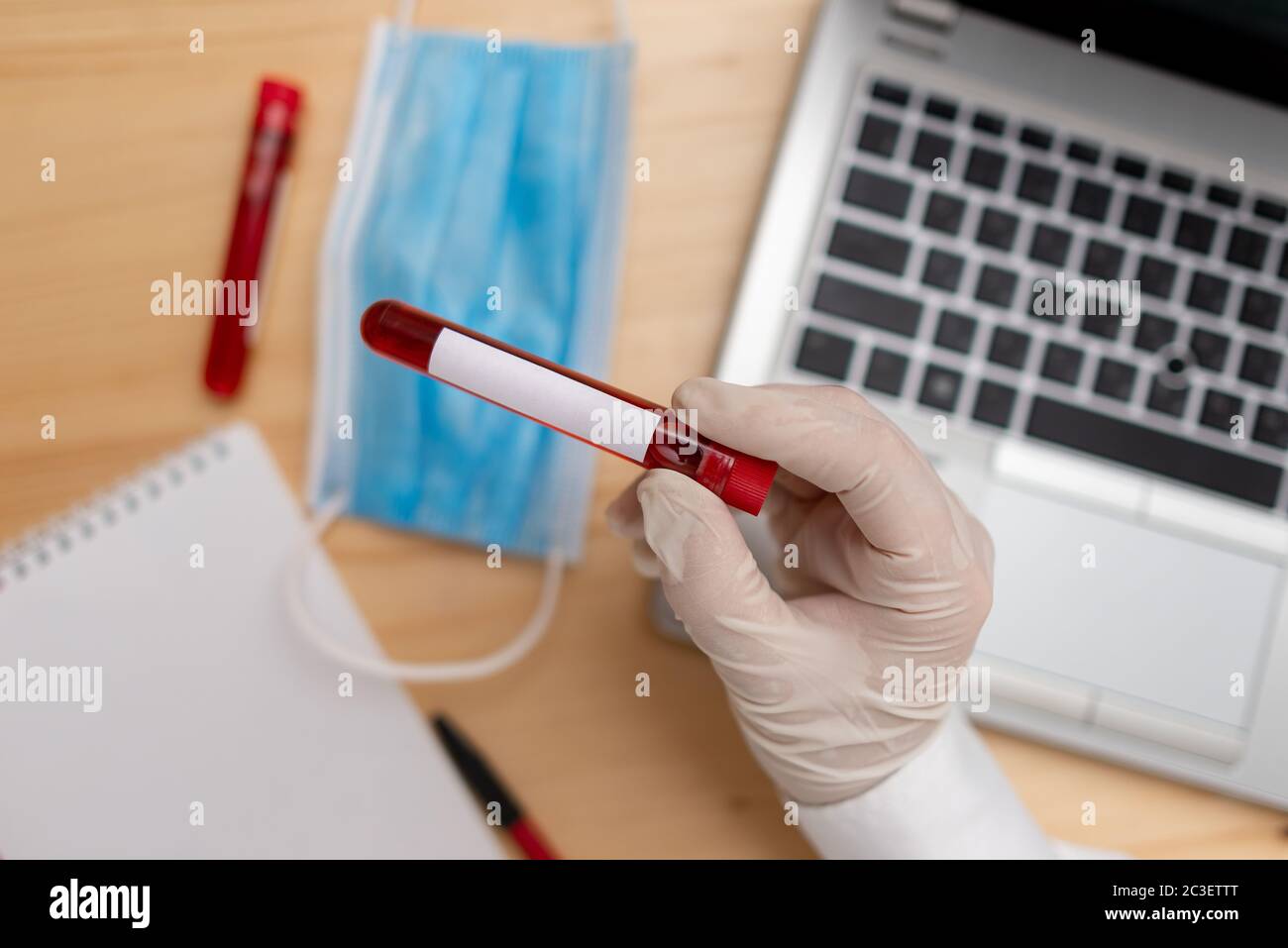 Extracted Blood Sample Vial With Lastest Technology Ready For ...