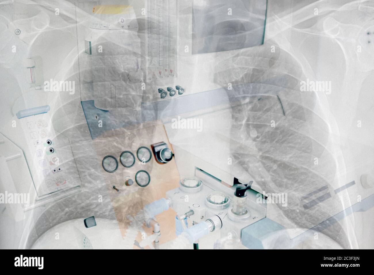 Double exposure of x-ray image of lung with pneumonia and ICU medical ...