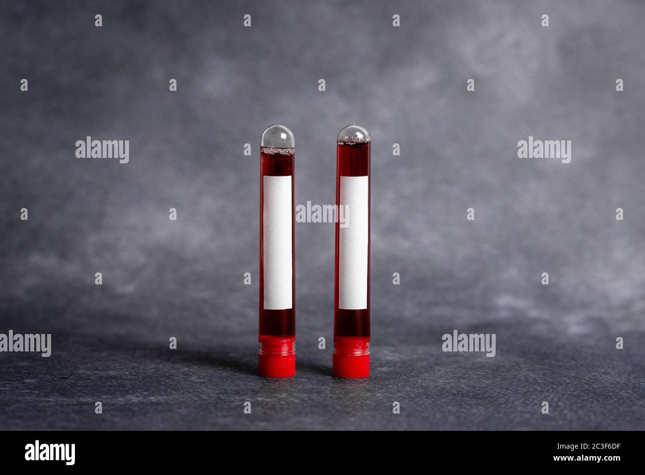 Extracted Blood Sample Vial With Medical Accessories Ready For ...
