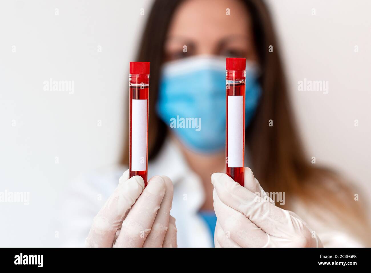 Laboratory Blood Test Sample Shown For Medical Diagnostic Analysis ...