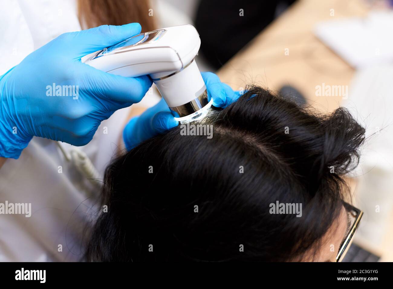 Microscopic examination of the hair and skin of the scalp Stock Photo ...