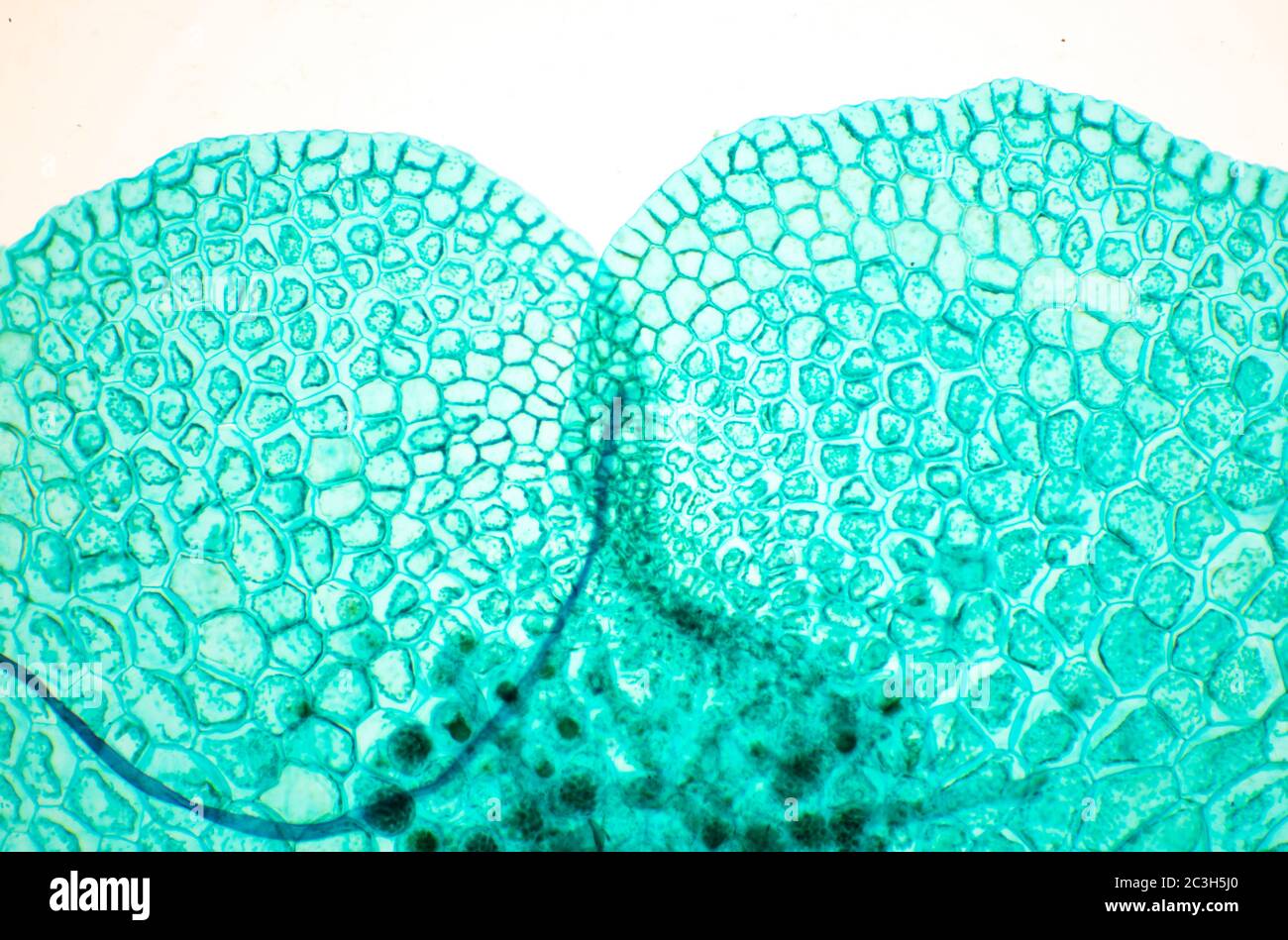 Fern Sporophyte Microscope