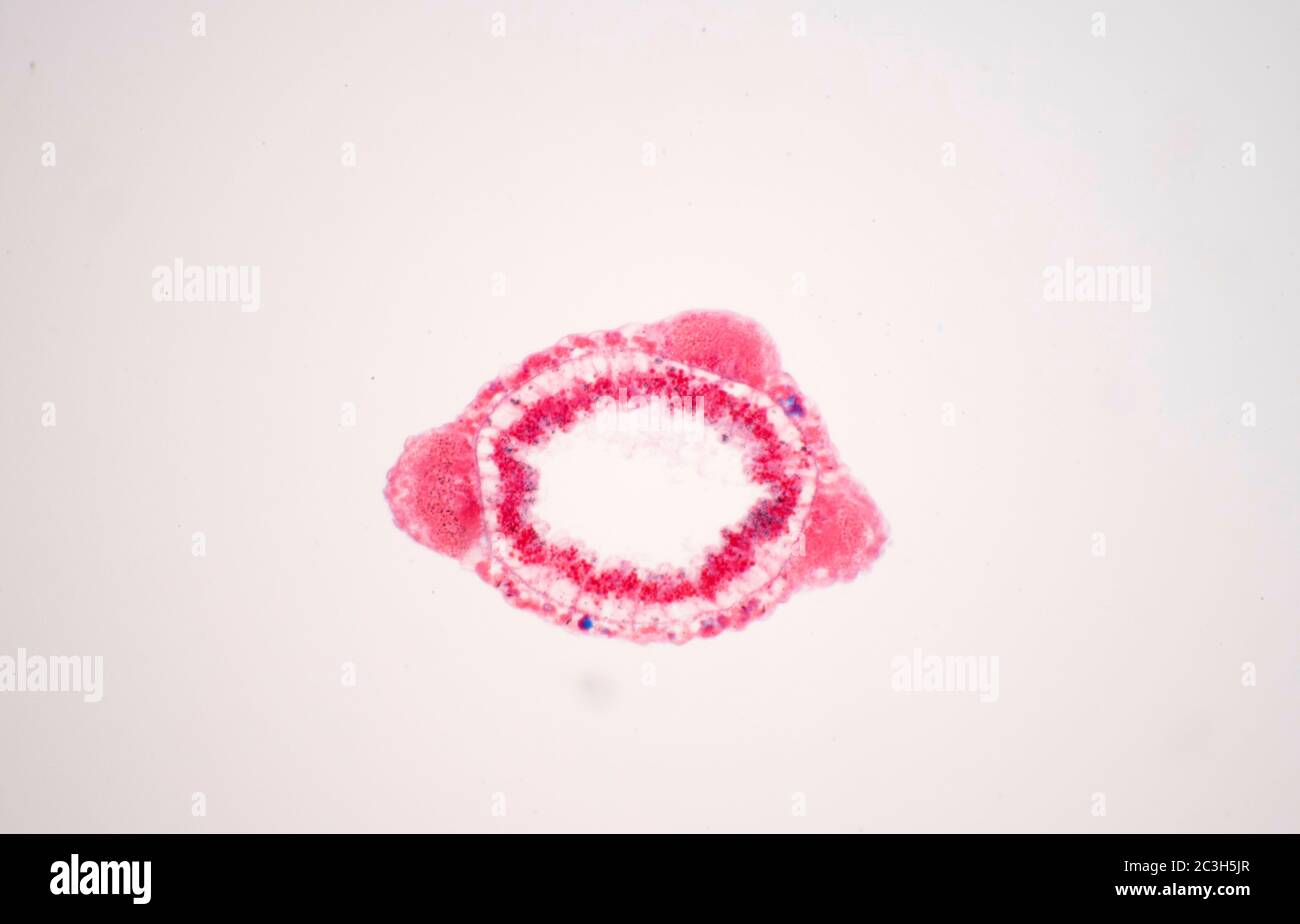 Hydra Under Microscope 40x