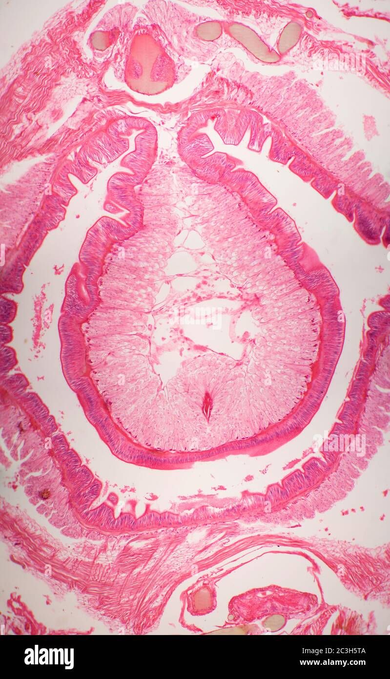 Lumbricus, transverse section through Typhlosole Stock Photo - Alamy