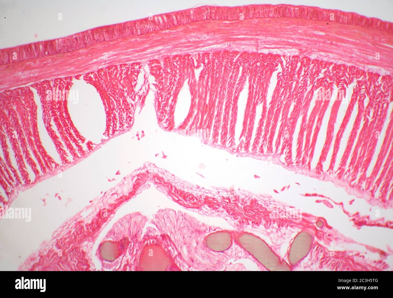Lumbricus, transverse section through Typhlosole Stock Photo - Alamy