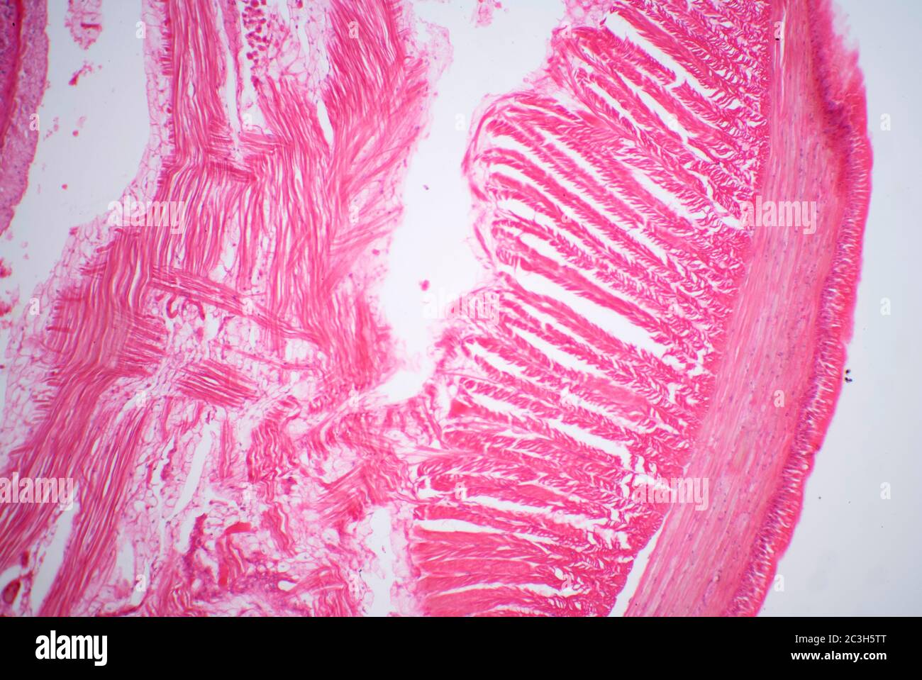 Lumbricus, transverse section through Typhlosole Stock Photo - Alamy