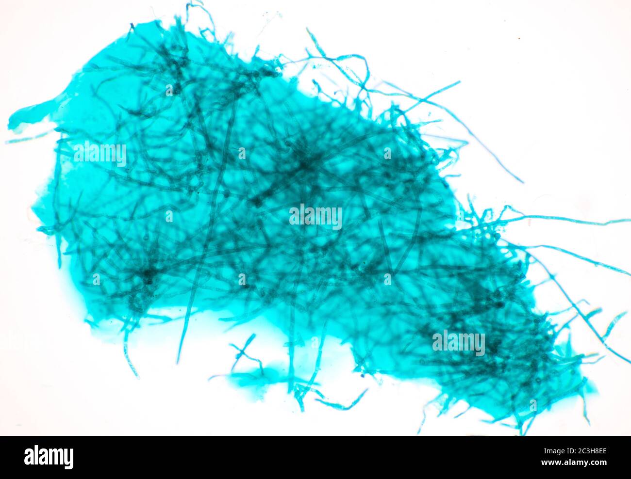 Moss Protonema Labeled