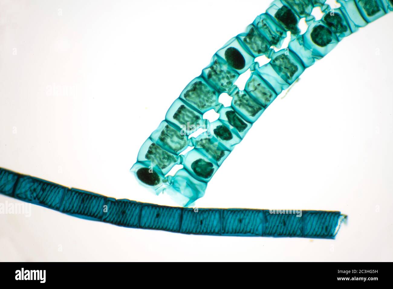 Chlorophyta Spirogyra Conjugation