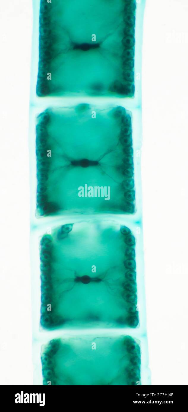 Spirogyra fresh water algae, microscope view Stock Photo - Alamy